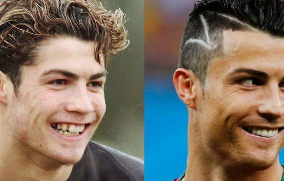 The Truth About Cristiano Ronaldo Plastic Surgeries!