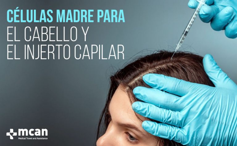 Tratamiento con células madre para el cabello | MCAN Health