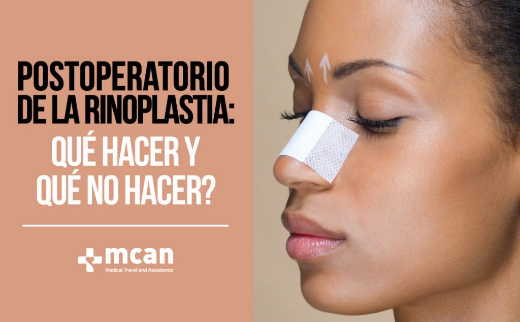 Postoperatorio de la Rinoplastia: Qué Hacer y Qué No Hacer? | MCAN ...