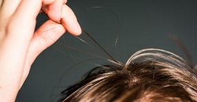 Trichotillomania (Hair Pulling Disorder) - Do You Think You Have It ...