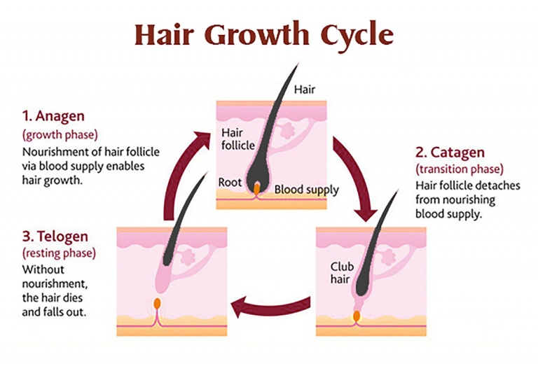 Hair Transplant Shedding Phase: Does Transplanted Hair Fall Out? | MCAN ...