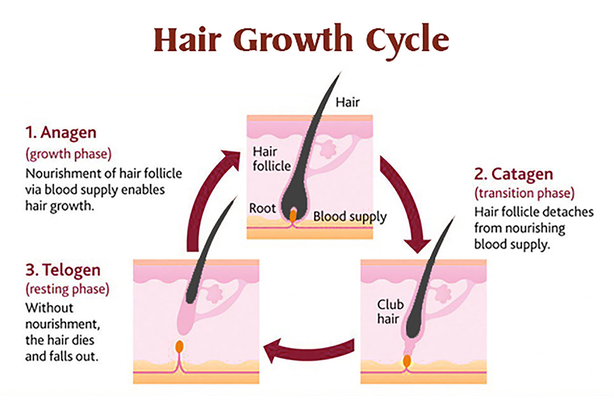 Hair Transplant Shedding Phase: Does Transplanted Hair Fall Out? | MCAN ...