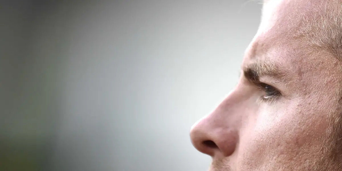 Male Rhinoplasty: Preserving and Enhancing the Masculinity | MCAN ...