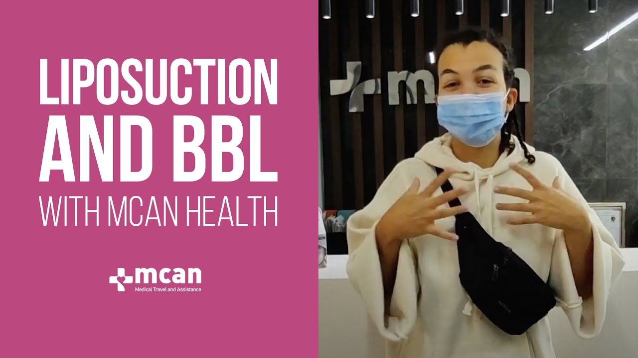 Liposuction Turkey Best Results and 2024 Prices - MCAN Health