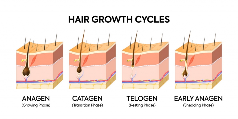 Hair Transplant Timeline: A Guide to Hair Transplant Recovery & Growth ...