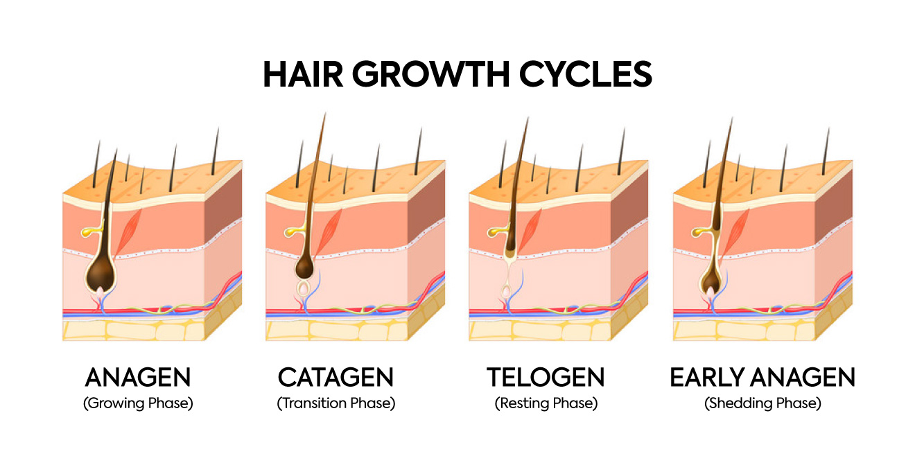 Hair Transplant Timeline: A Guide to Hair Transplant Recovery & Growth ...