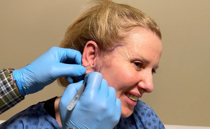 The Ultimate Guide to Facelift Procedures: Which One is Right for You? | MCAN Health Blog