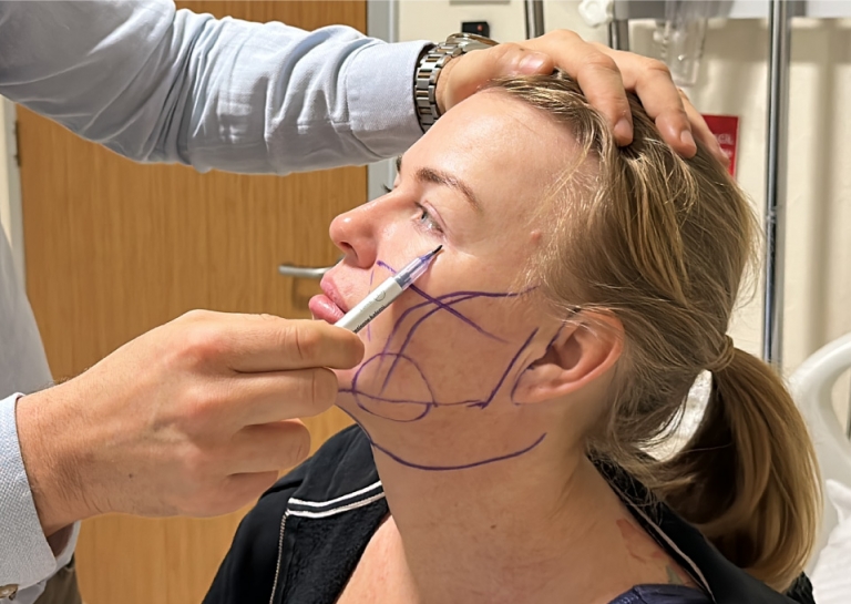 The Ultimate Guide to Facelift Procedures: Which One is Right for You ...