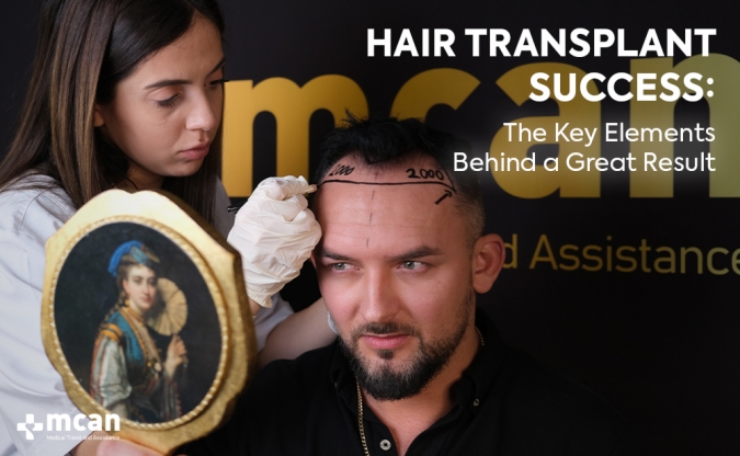 Hair Transplant Success: The Key Elements Behind a Great Result | MCAN ...