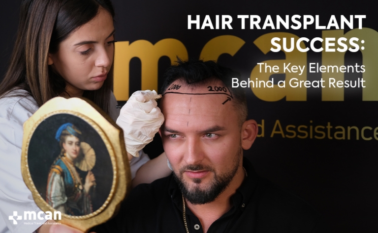 Hair Transplant Success: The Key Elements Behind a Great Result | MCAN ...