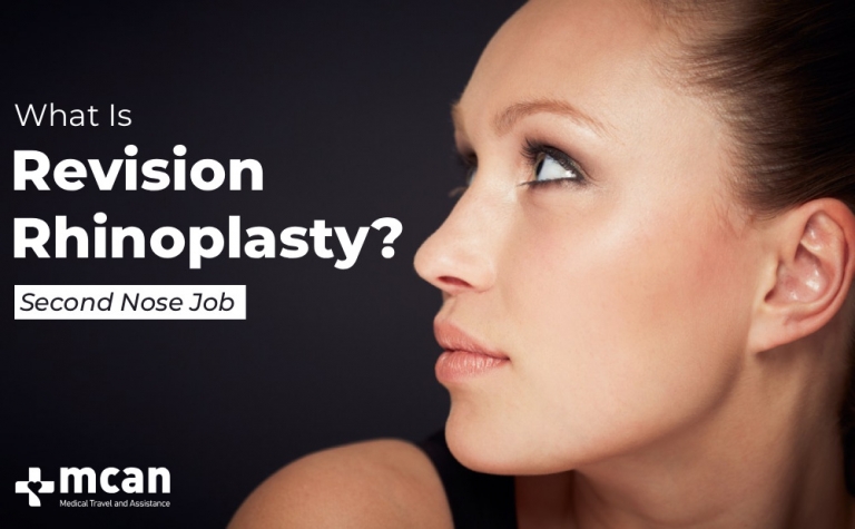 What Is Revision Rhinoplasty? When and Why a Second Nose Job Is Needed ...