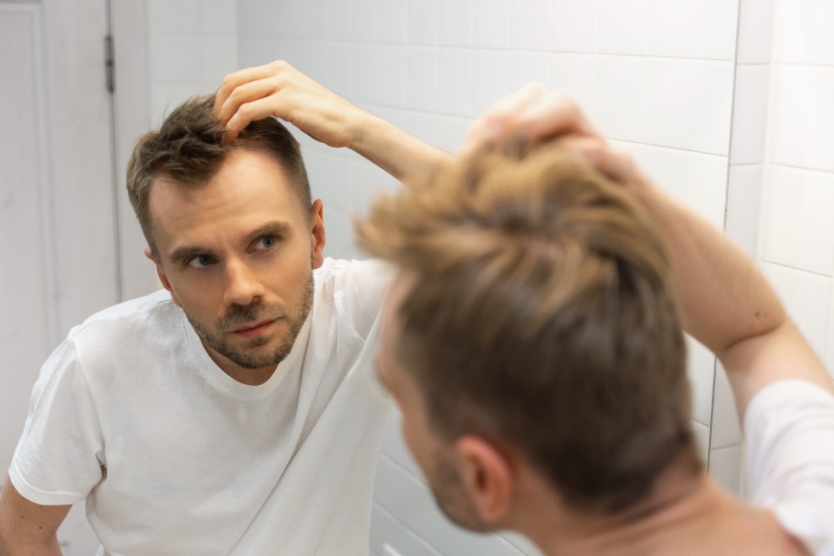 What Is Diffuse Thinning? Can a Hair Transplant Fix It? | MCAN Health Blog
