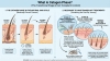 Catagen Phase | MCAN Health Glossary