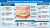 What is Seroma? | MCAN Health Glossary