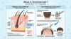 Terminal Hair | MCAN Health Glossary