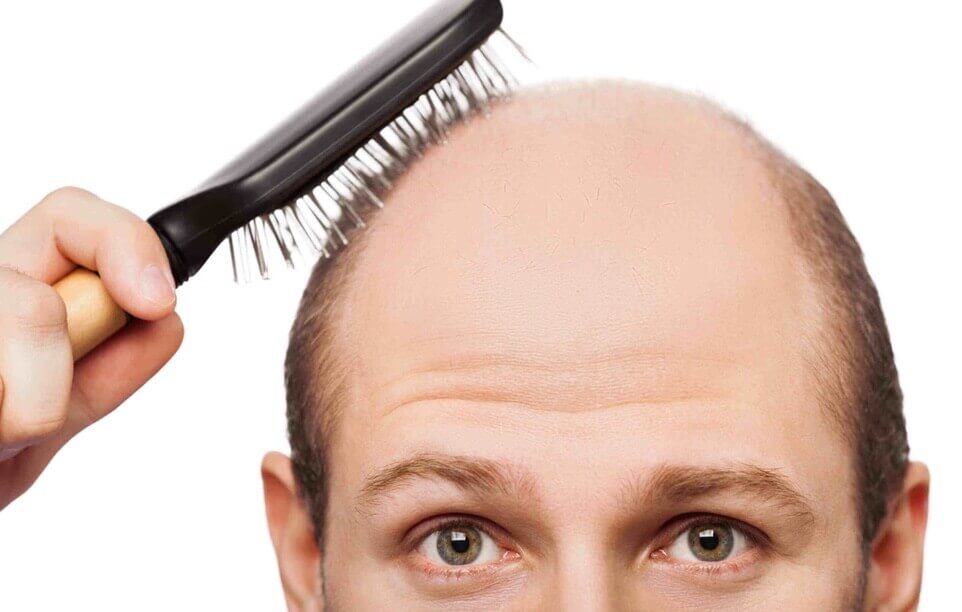Haartransplantatie Turkije | Haarutival Behandeling | MCAN Health